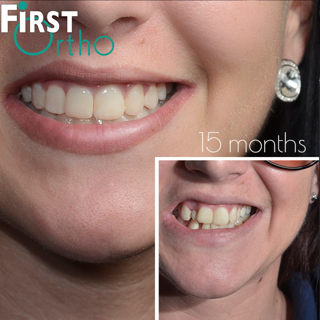 Fast Track - First Ortho