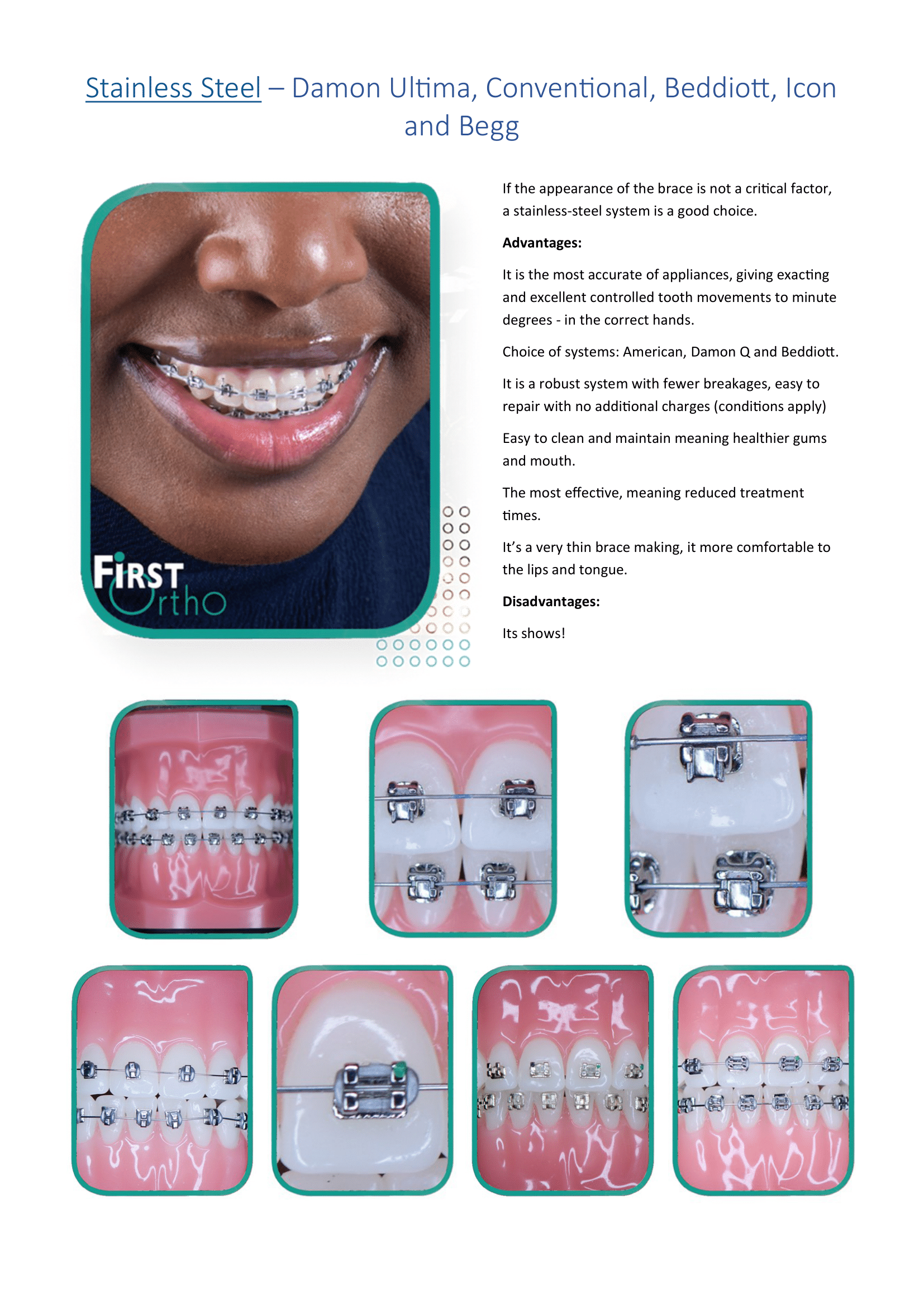Discover Our Braces - Modern Orthodontics FIRST Ortho